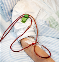 Peritoneal Dialysis Devices - Products - Home Dialysis Central